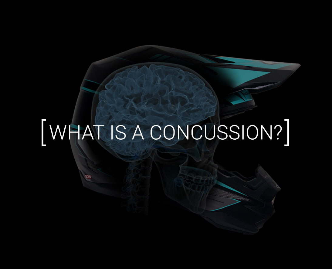 What is a Concussion? – 6D Helmets Europe